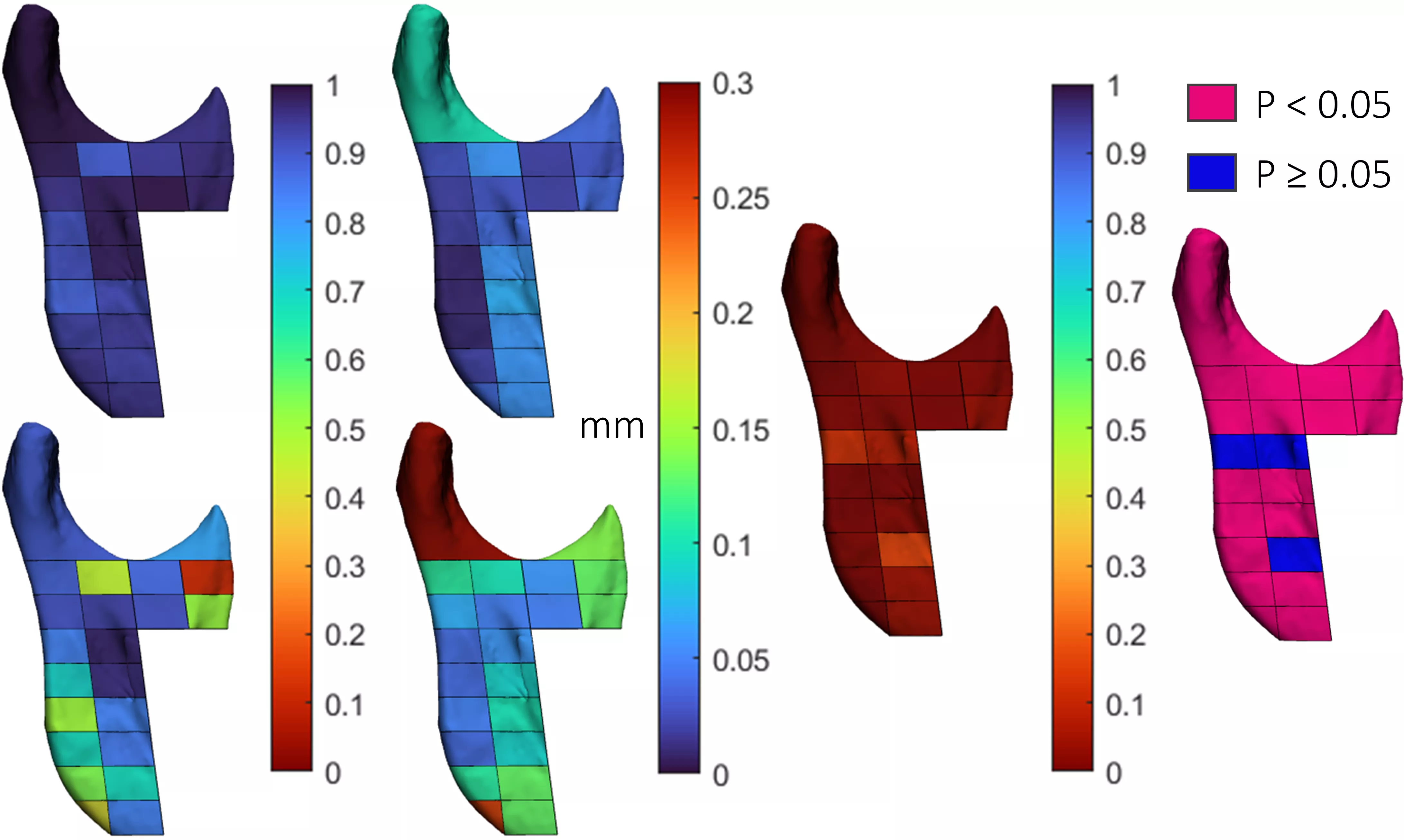 Comparison of Surface- and Voxel-Based Registration on the Mandibular Ramus for Long-Term Three ...